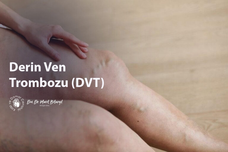 Derin Ven Trombozu: Belirtiler, Nedenler ve Tedavisi