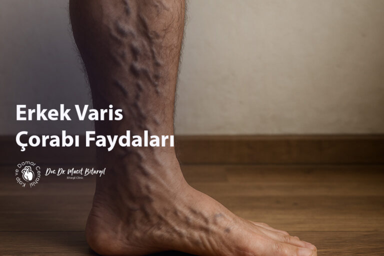 Erkek Varis Çorabı Faydaları - Dolaşımı Destekleyen Çözümler
